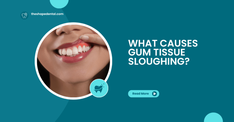 What Causes Gum Tissue Sloughing and How to Stop It?
